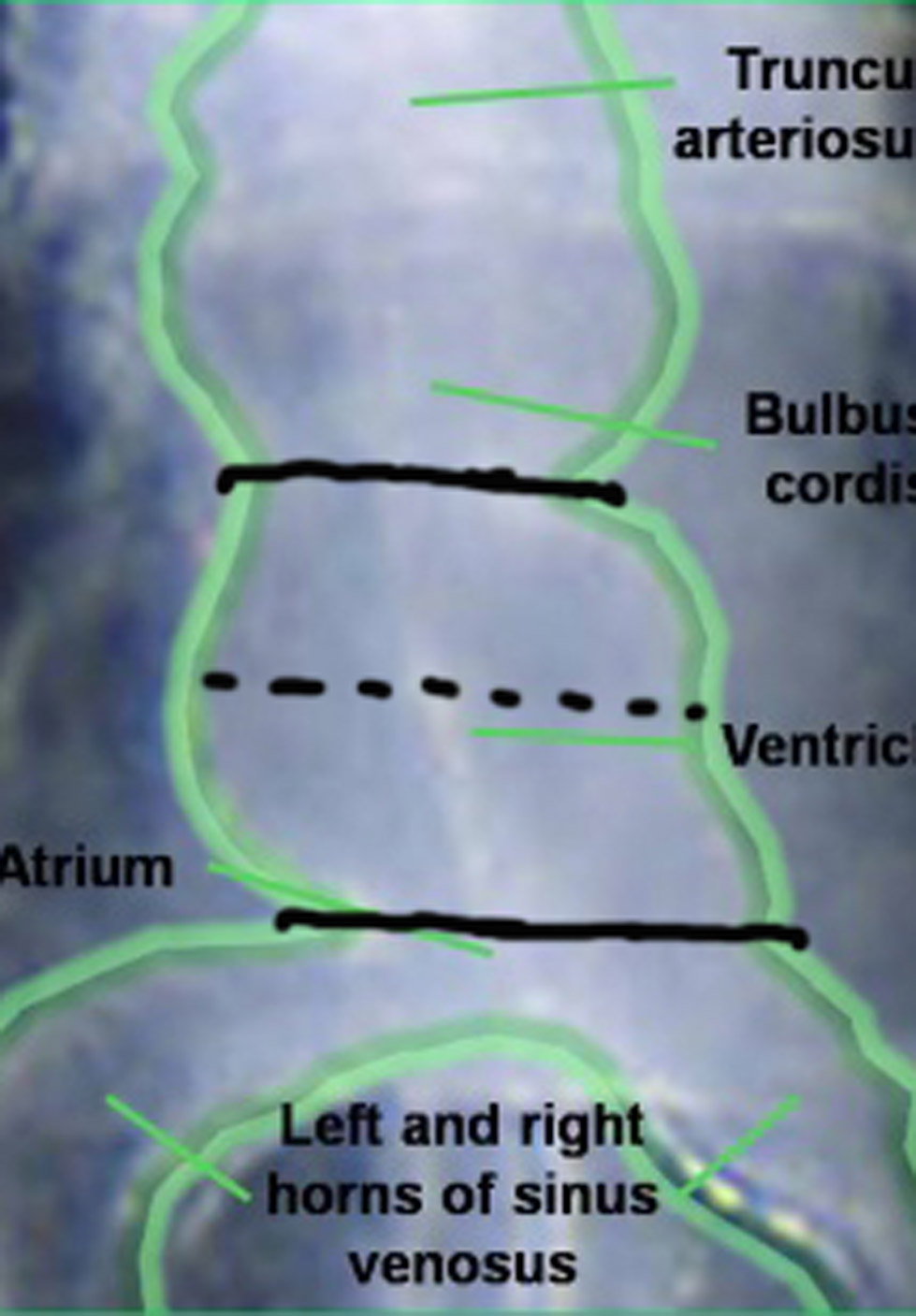Human Cardiogenesis – Mātai Medical Research Institute